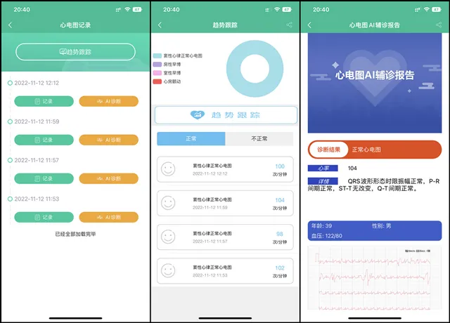 dido E10專業級測血壓智能手錶，你的貼身醫護保鏢 – PCNow